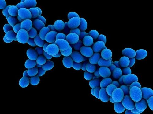 Colloidal Silver Uses - Bacterial - Colloidal Silver for Infections